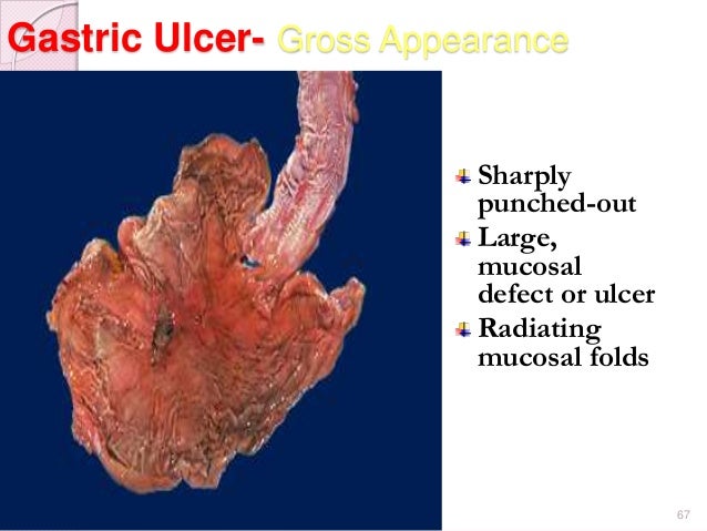 Stomach pathology lecture