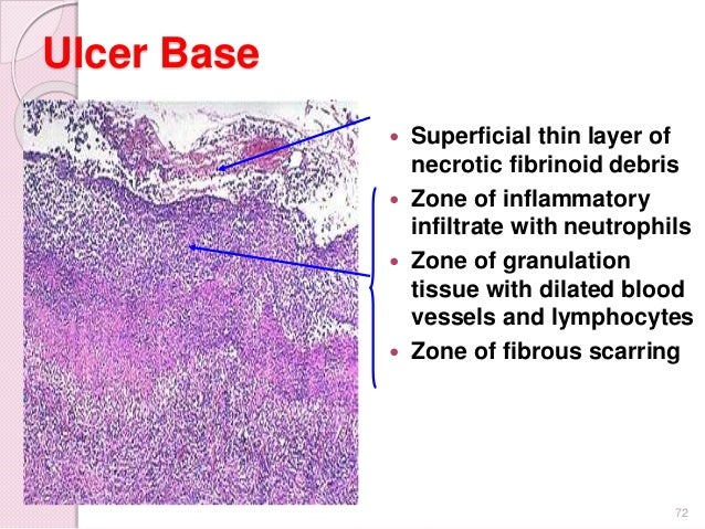 Stomach pathology lecture