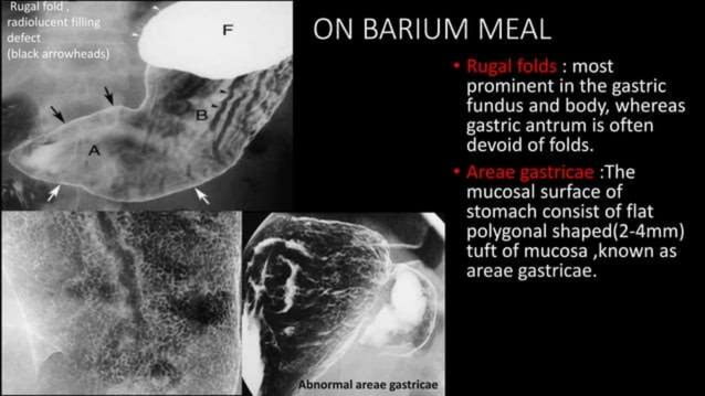 stomach-radiology.pptx