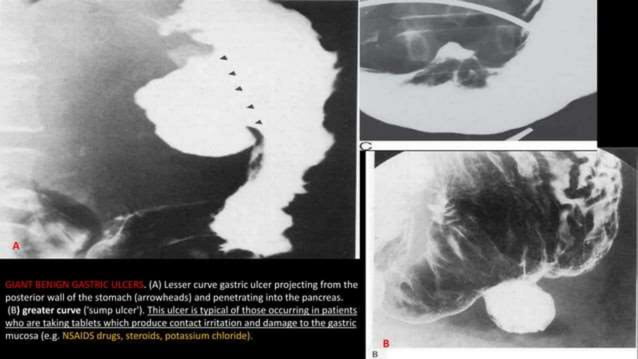 stomach-radiology.pptx