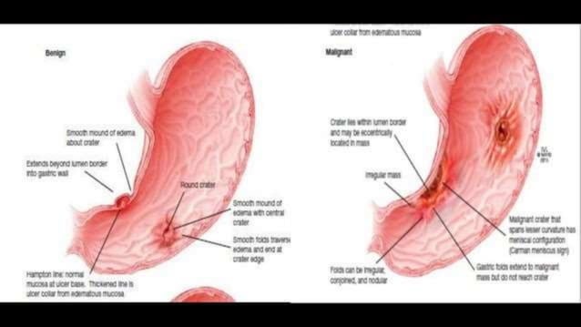 stomach-radiology.pptx