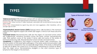 STOMACH CANCER-introduction to cancers-.pptx