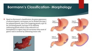 STOMACH CANCER-introduction to cancers-.pptx