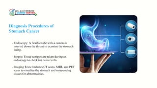 Brief Overview on Stomach Cancer Surgery.pdf