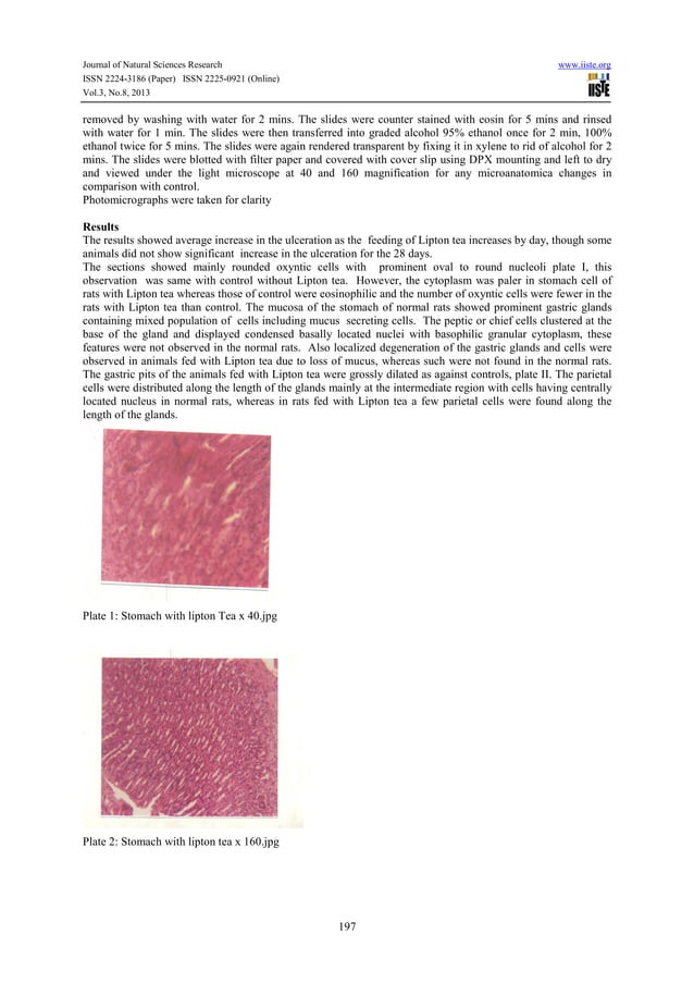 Stomach histopathologic and ulcerogenic potentials of tea beverage | PDF