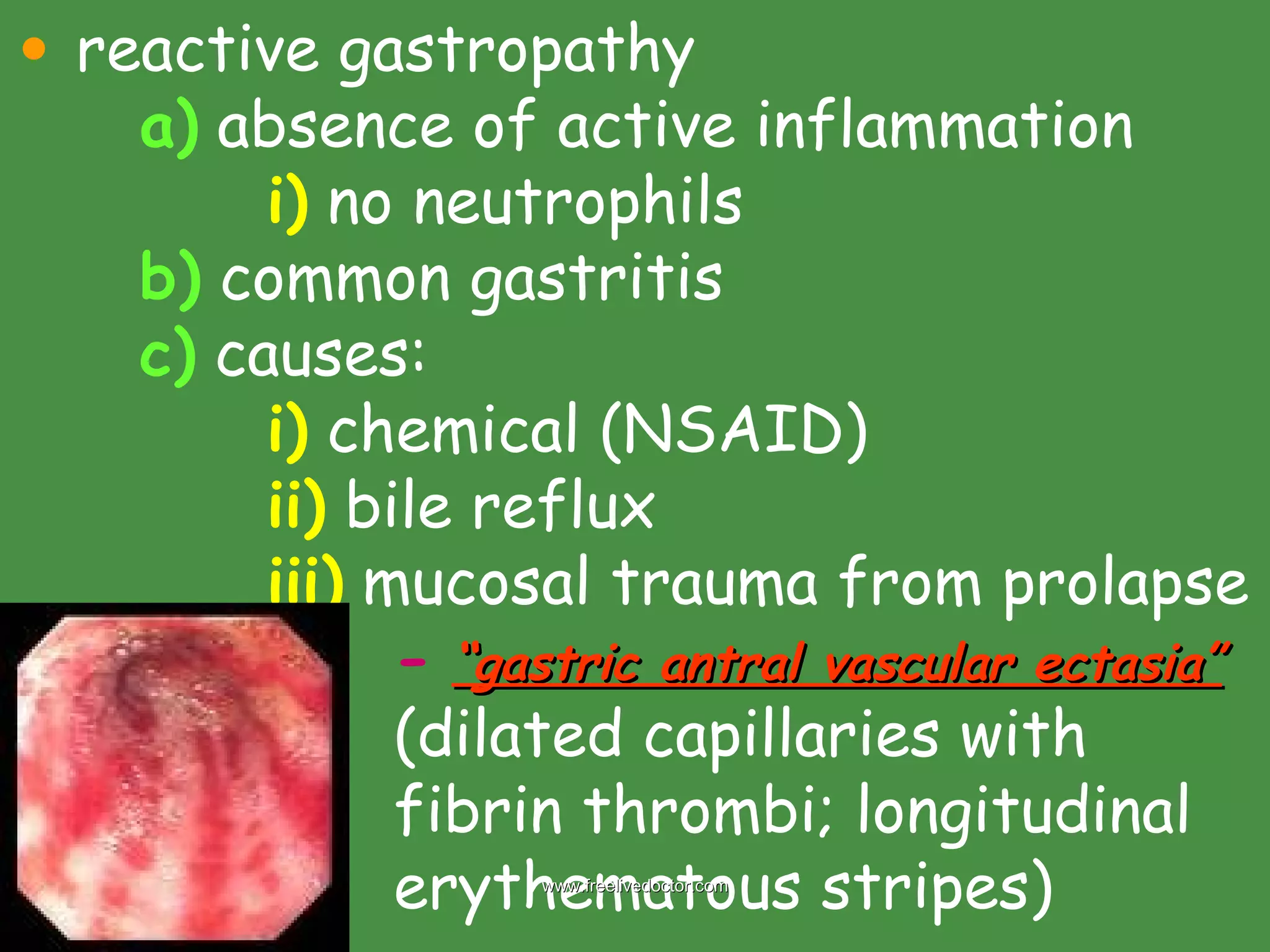 Stomach pathology | PPT