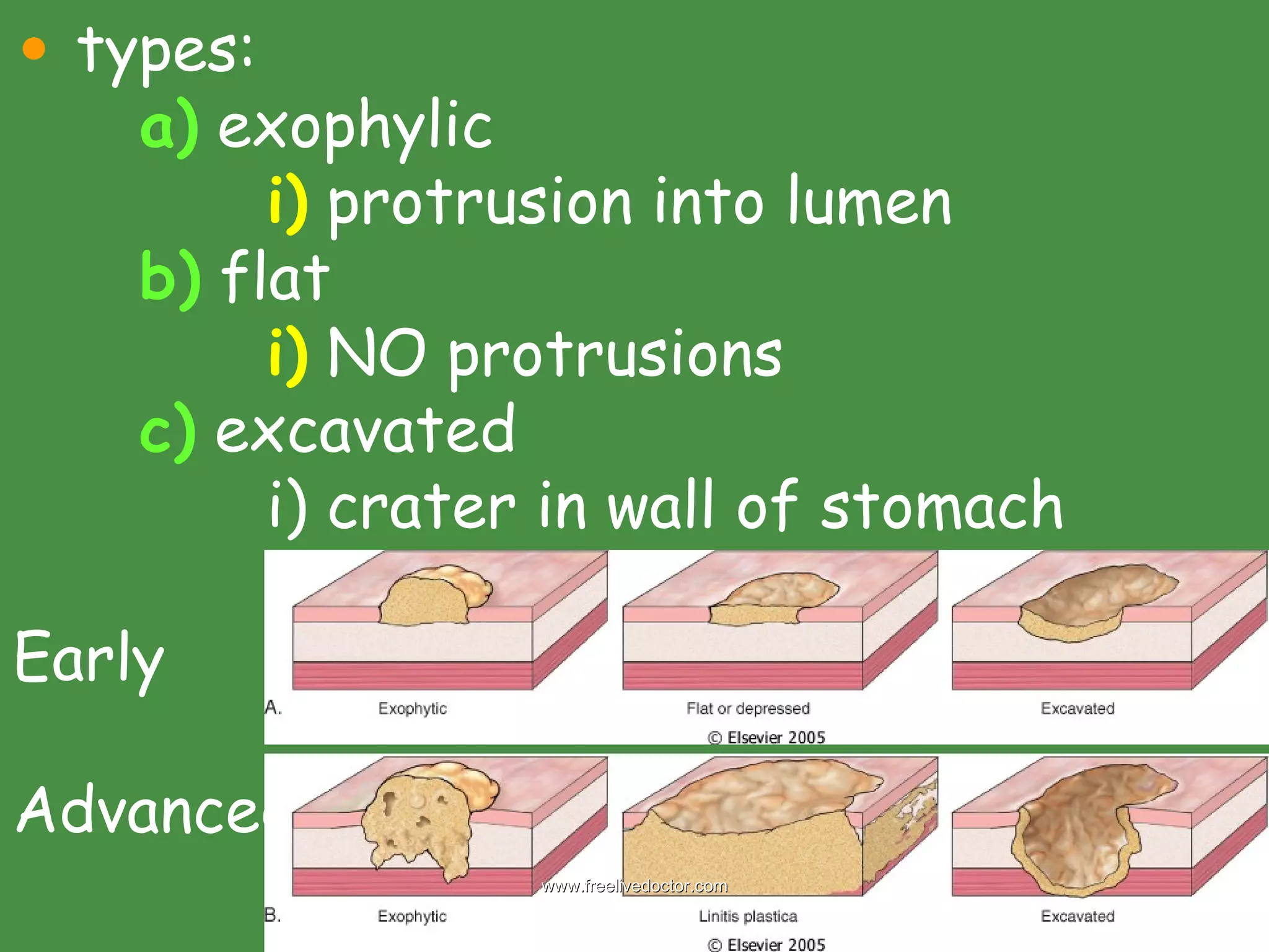 Stomach pathology | PPT