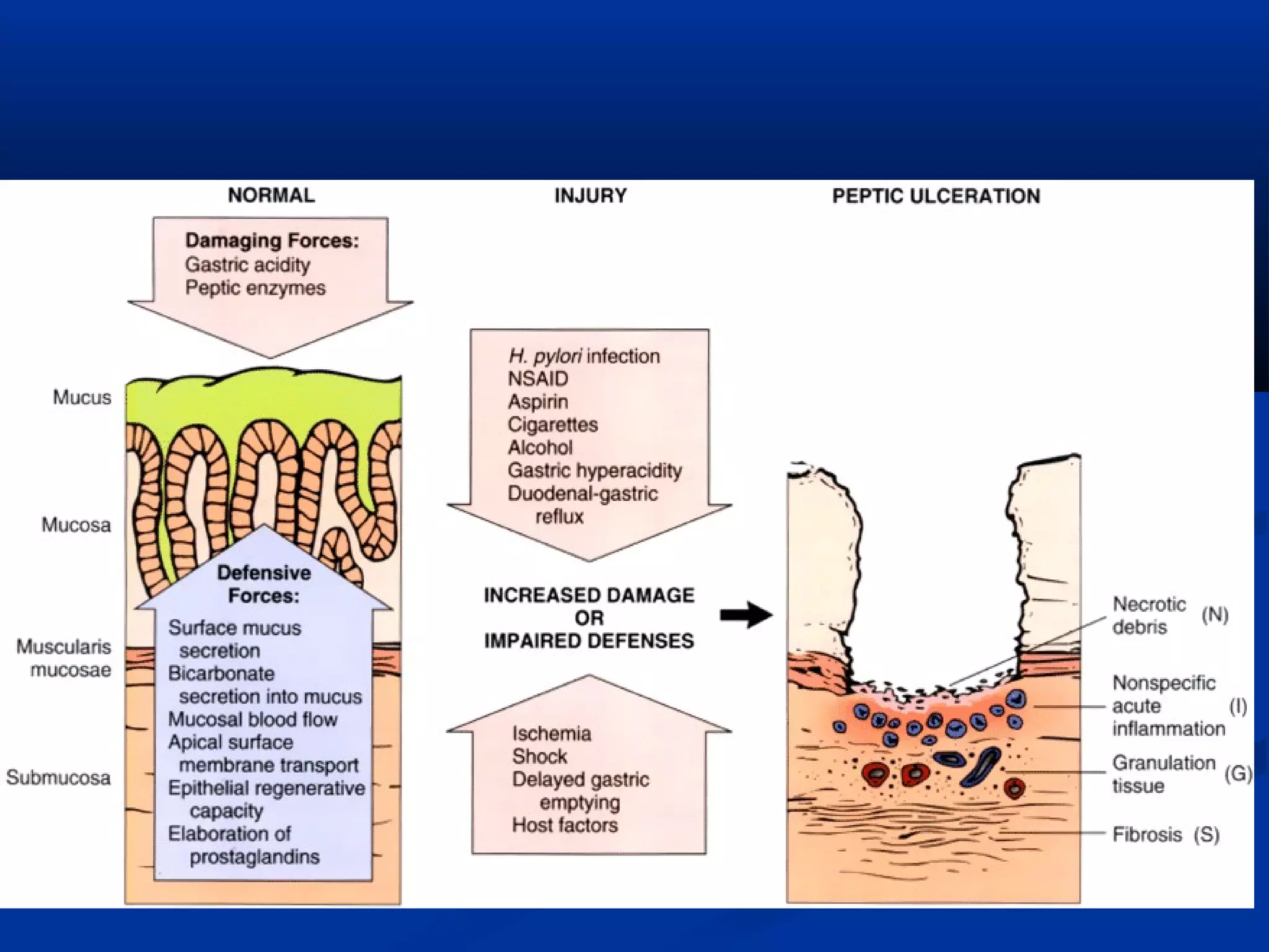 Stomach pathology | PPT