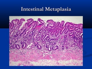 Stomach pathology | PPT