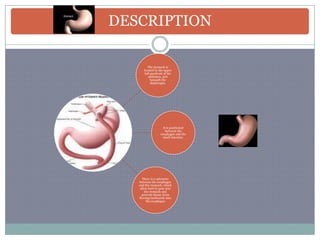 Stomach Presentation | PPSX