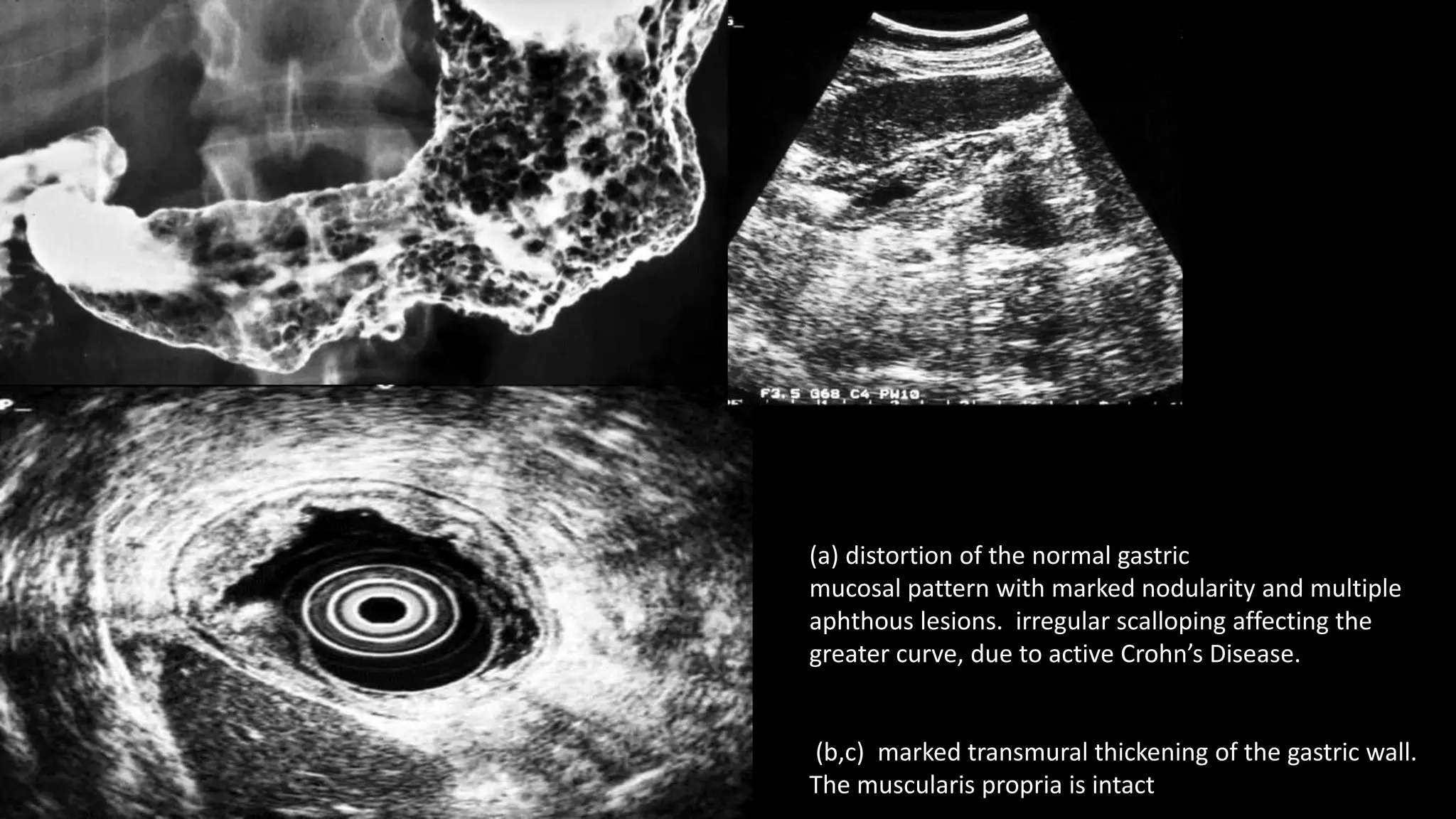 Stomach radiology | PPTX