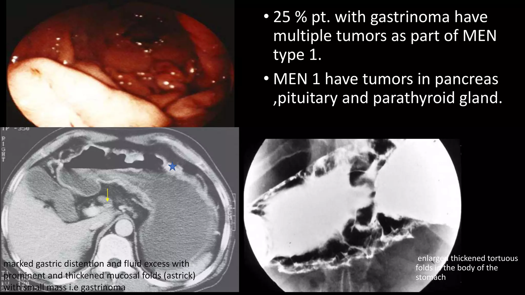 Stomach radiology | PPTX
