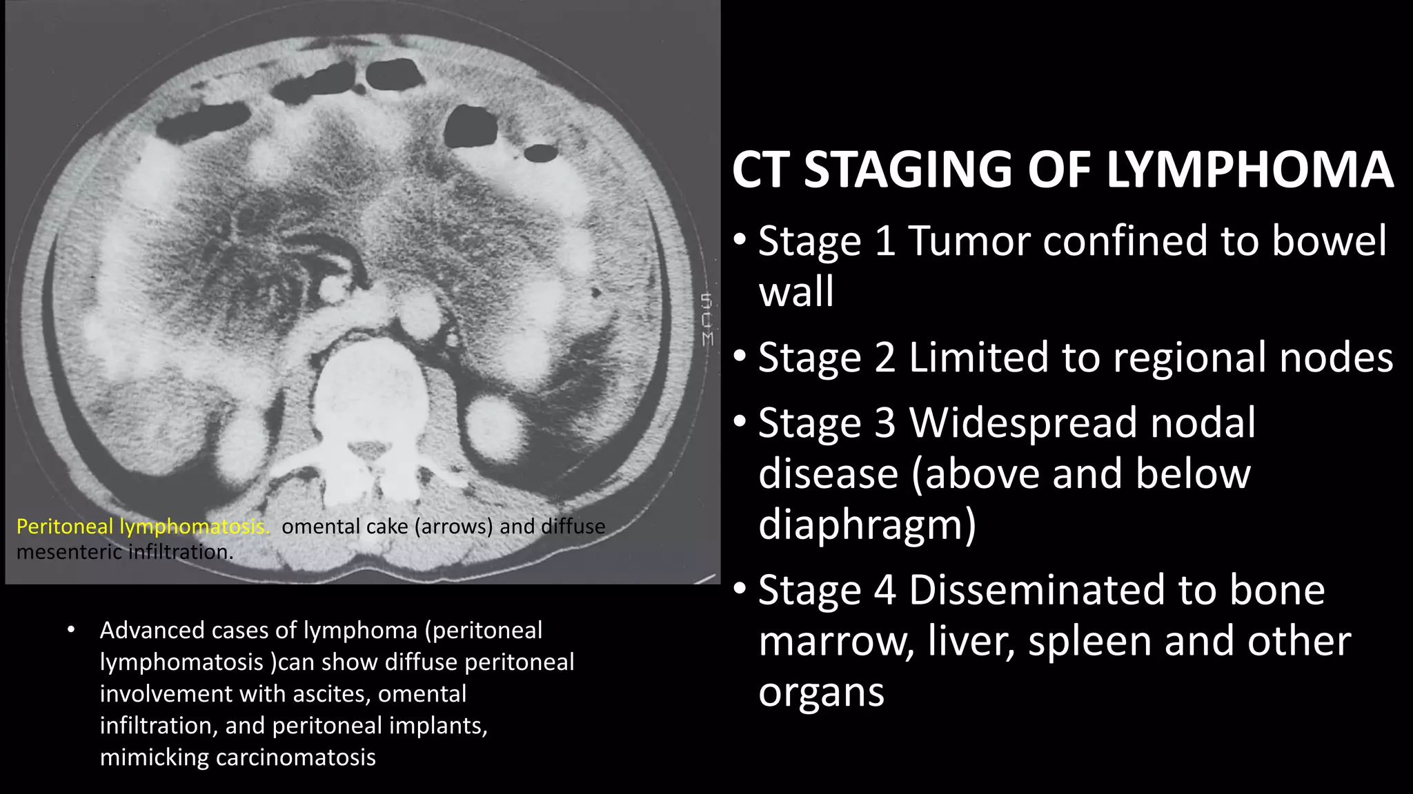 Stomach radiology | PPTX
