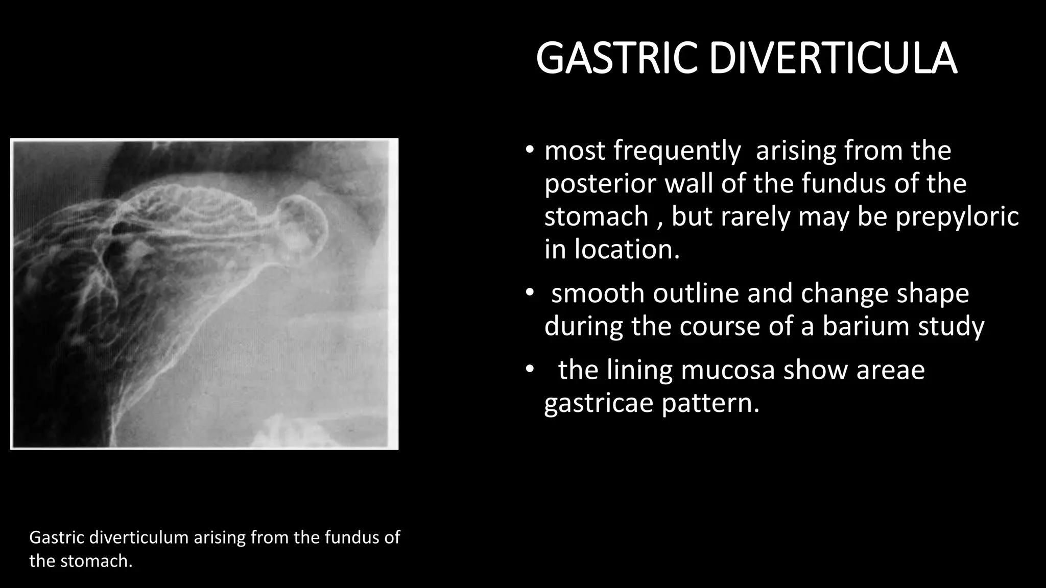 Stomach radiology | PPTX