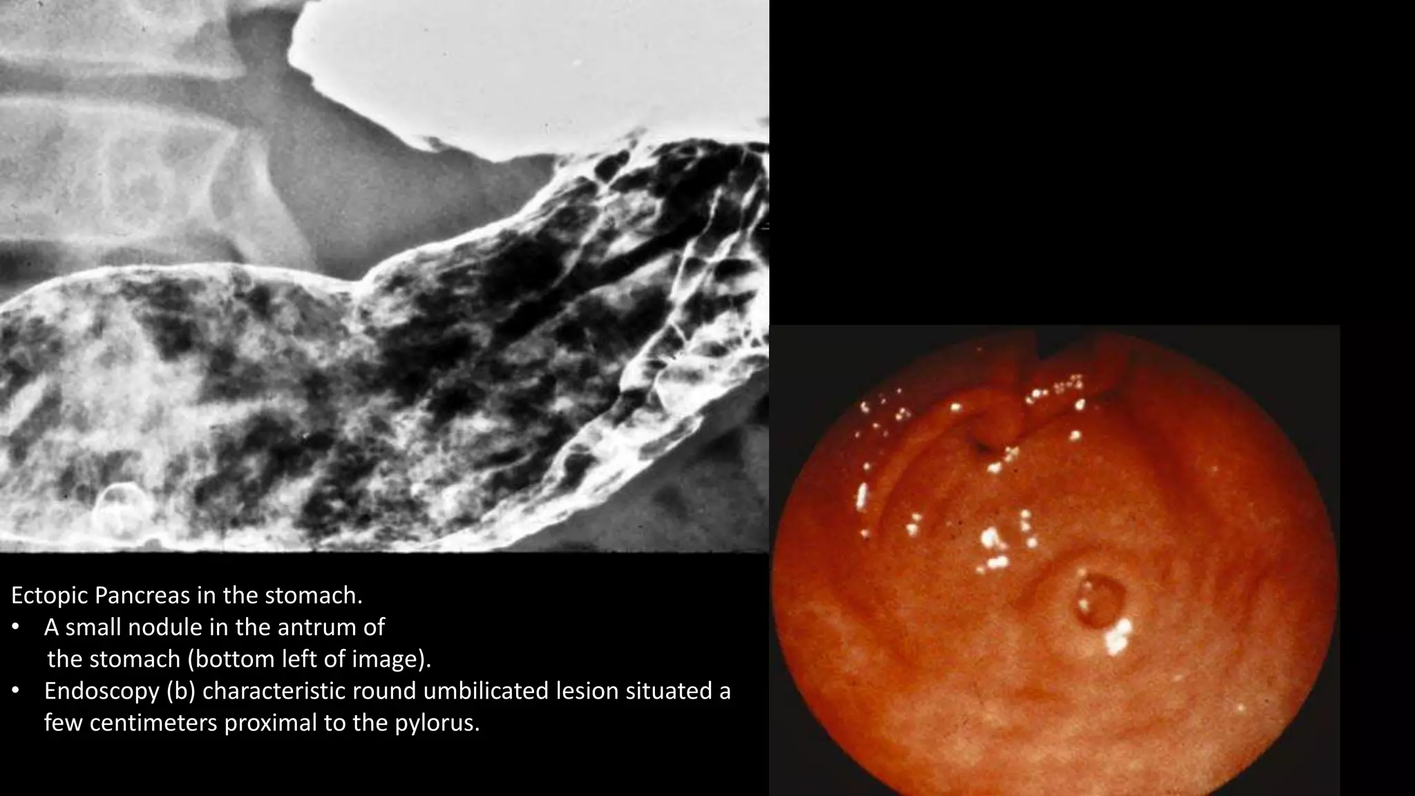Stomach radiology | PPTX