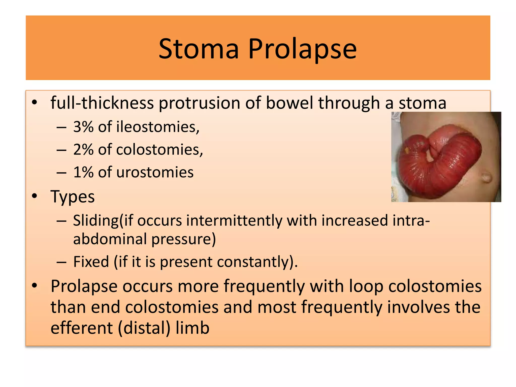 Stoma complications by Prof. Ajay Khanna, IMS, BHU, Varanasi India | PPTX