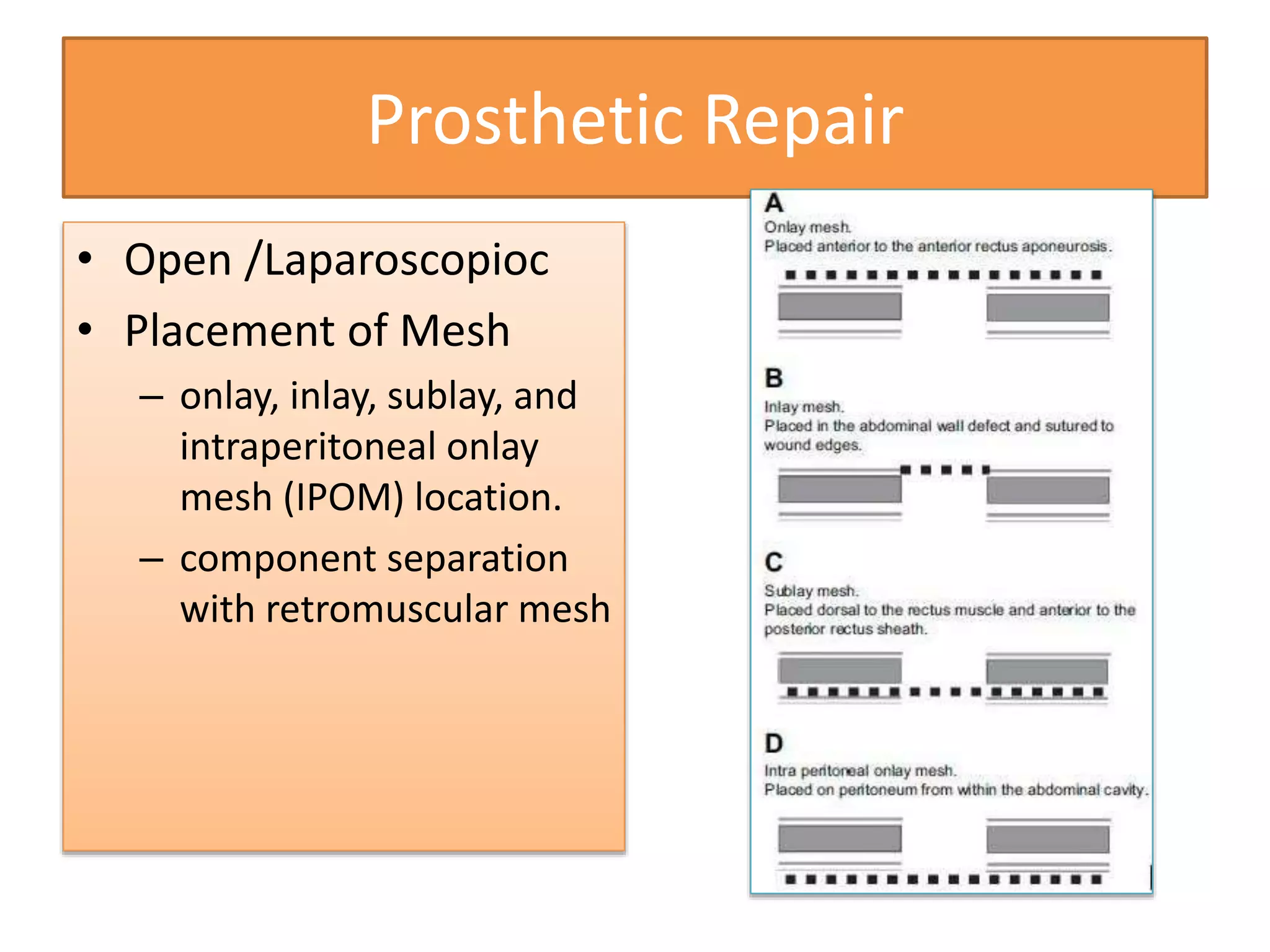 Stoma complications by Prof. Ajay Khanna, IMS, BHU, Varanasi India | PPTX