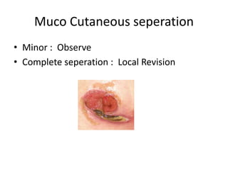 Stoma complications by Prof. Ajay Khanna, IMS, BHU, Varanasi India | PPT