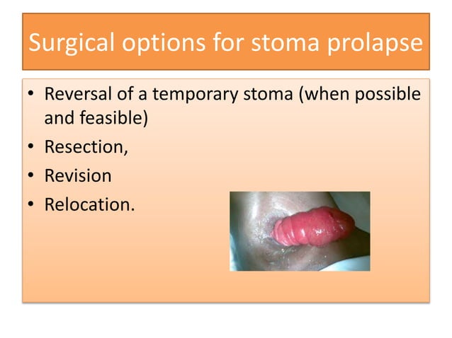 Stoma complications by Prof. Ajay Khanna, IMS, BHU, Varanasi India