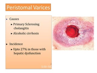 Stoma complications by Prof. Ajay Khanna, IMS, BHU, Varanasi India