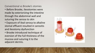 Stoma indication | PPTX
