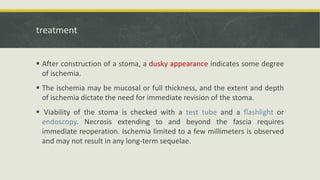 Stomal complication | PPT