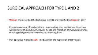 STOMAL RECURRENCE AFTER LARYNGECTOMY-1.pptx