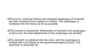 STOMAL RECURRENCE AFTER LARYNGECTOMY-1.pptx