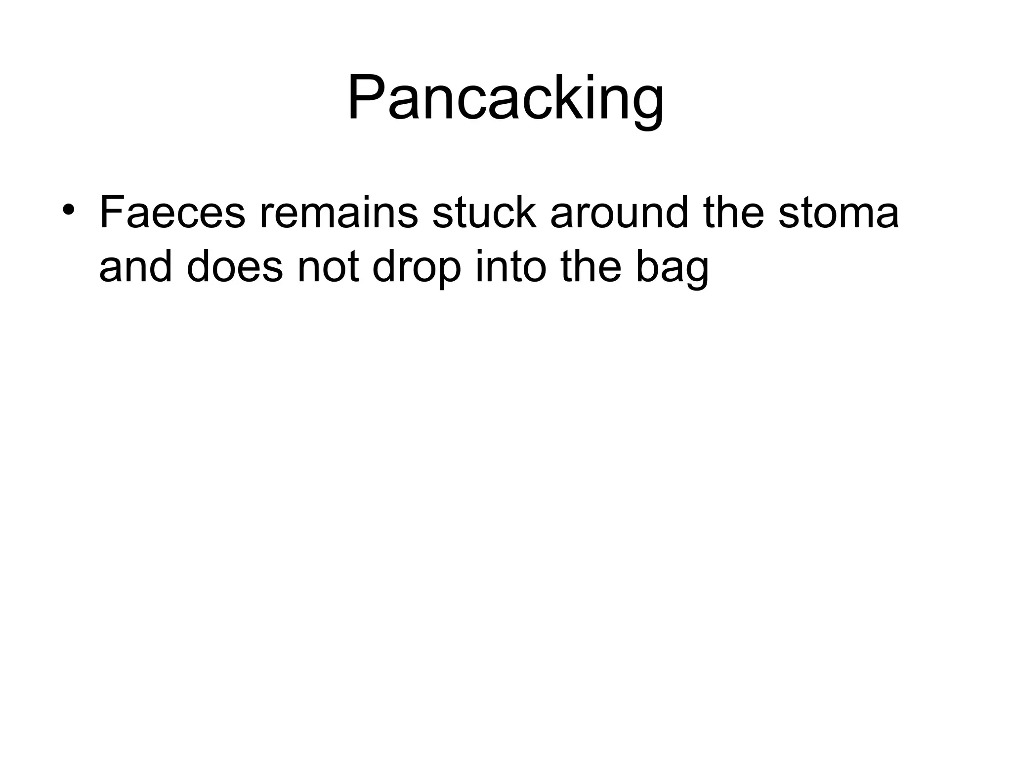 Stoma modules troubleshooting workshop | PPT