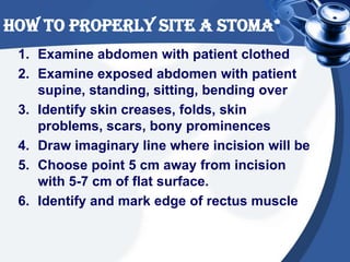 Stomas | PPT