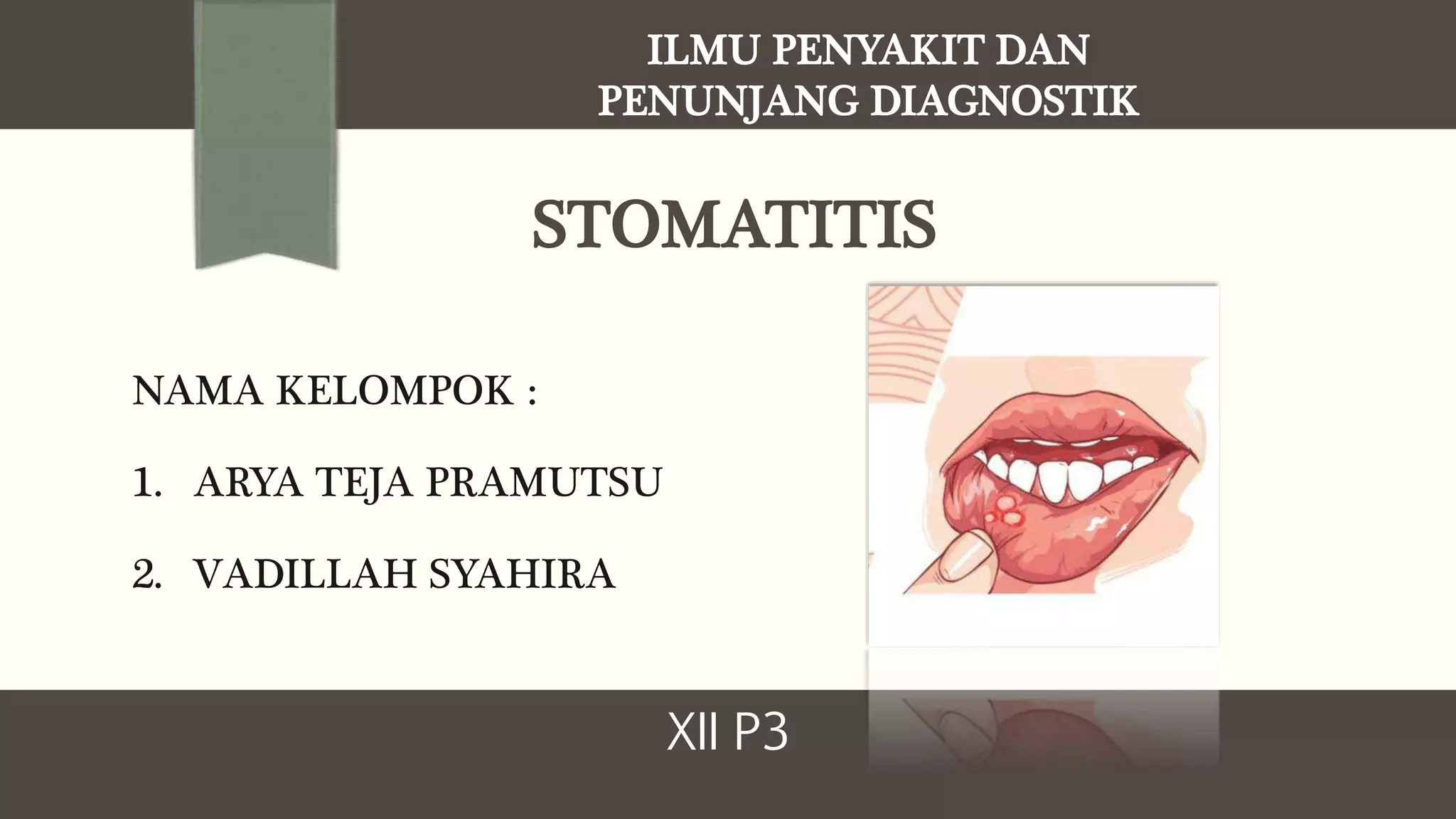 Stomatitis | PPTX