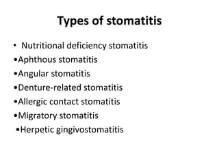 Stomatitis (AHN) | PPTX