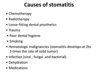 Stomatitis Treatment