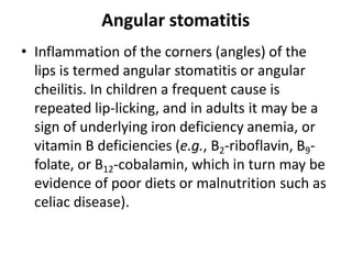 stomatitis3-161023041115 (1).pptx