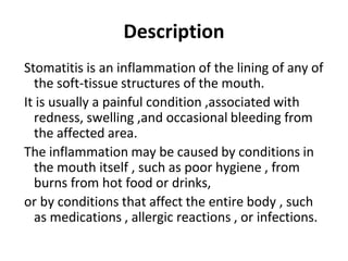 stomatitis3-161023041115 (1).pptx