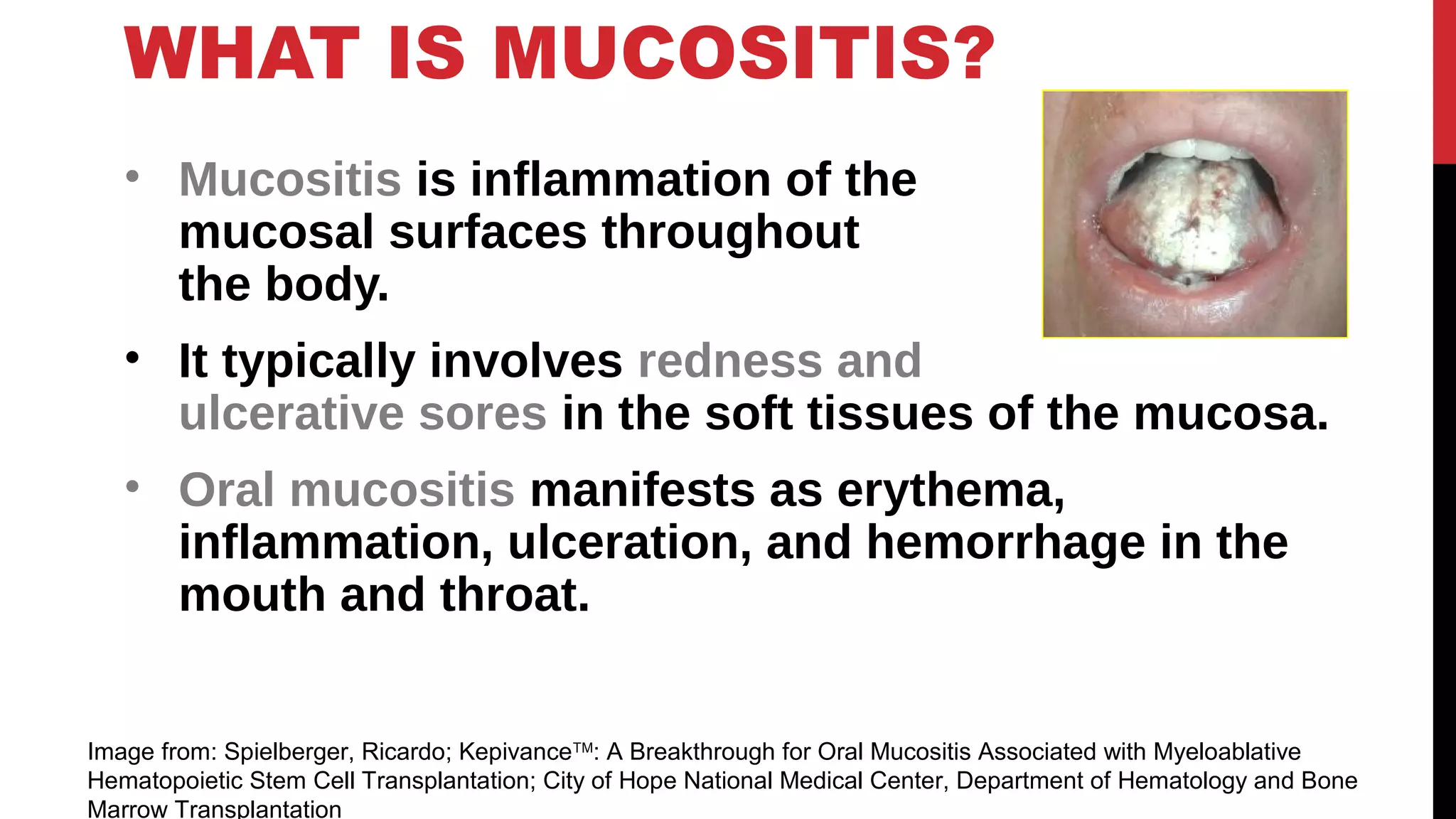 Stomatitis in oncology | PPT