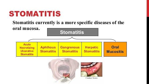 Stomatitis in oncology