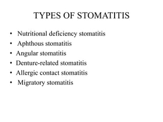stomatits.pptx