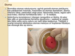 Stomu aprūpe.ppt
