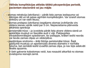 Stomu aprūpe.ppt