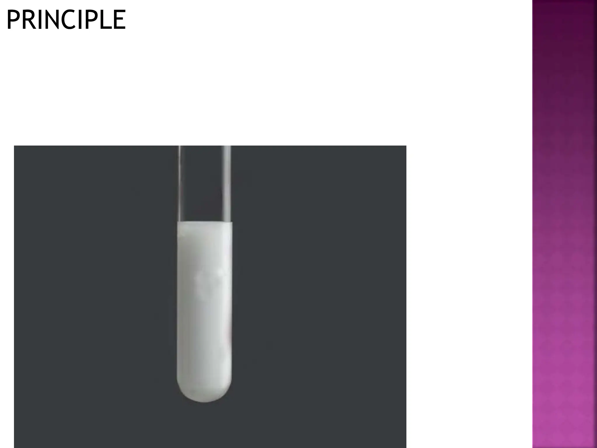 stone analysis renal,gall stone, ureteric stones.pptx