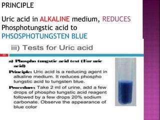 stone analysis renal,gall stone, ureteric stones.pptx
