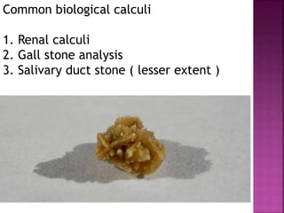stone analysis renal,gall stone, ureteric stones.pptx