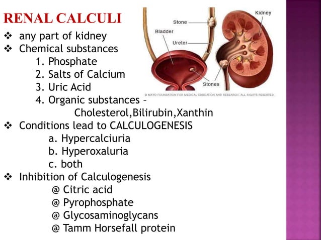 stone analysis renal,gall stone, ureteric stones.pptx | Chemistry | Science