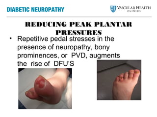 The Diabetic Foot: What You Need to Know | PPT