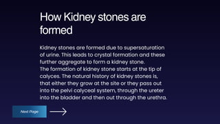 Kidney Stones: Causes, Symptoms, and Management | PDF