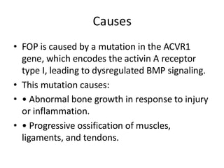 Stoneman syndrome (fibrodysplasia ossificans progressiva ).pdf