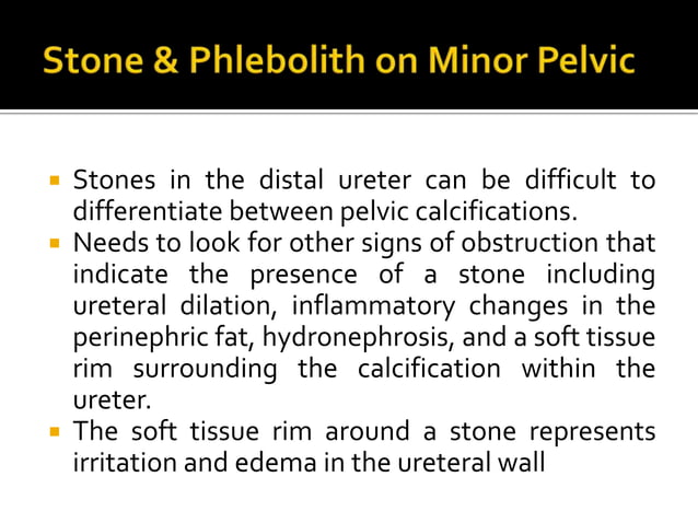 Stone & Phlebolith | PPT