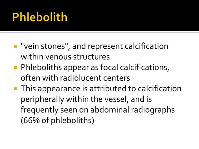 Stone & Phlebolith | PPT