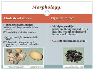 Stones of the gall bladder | PPTX